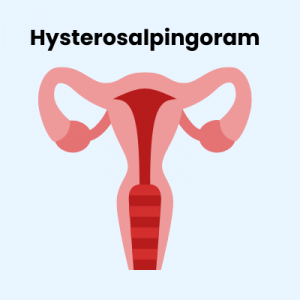 What is HSG (Hysterosalpingogram) & HSG Test Procedure? - Dr. Shikha ...